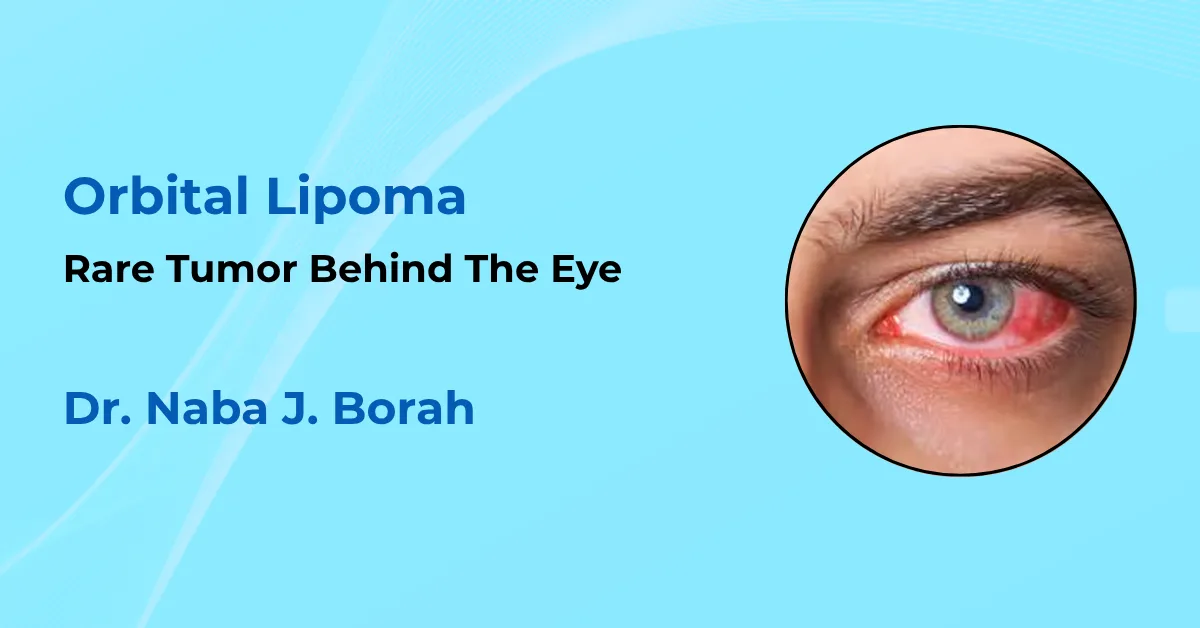 Orbital Lipoma – Rare Tumor Behind the Eye - Dr Naba J Borah